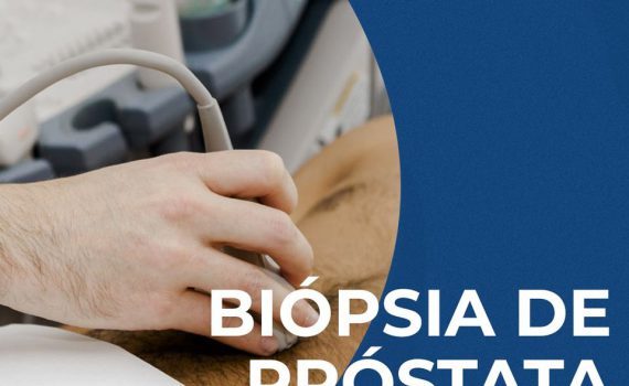 Biópsia de Próstata – Mega Imagem – Centro de Diagnóstico | Vilhena ...